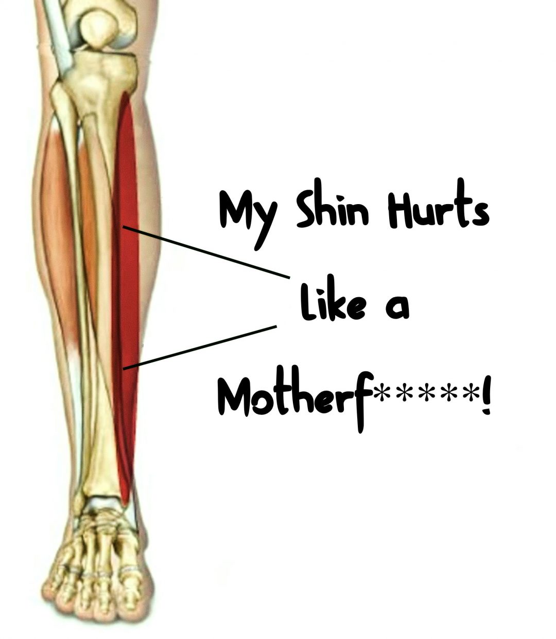 Shin Splint Pain